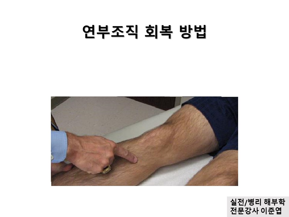 깅의제목 무릎내측통증의 시작인 거위발 근육에 대하여 알아보자 강사 이준엽pt 네이버 블로그